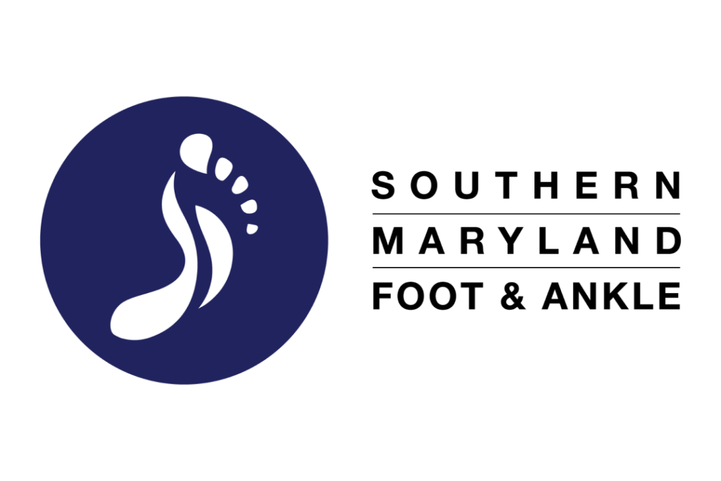 Abnormal Growths in the Foot: What You Need to Know - Southern Maryland ...